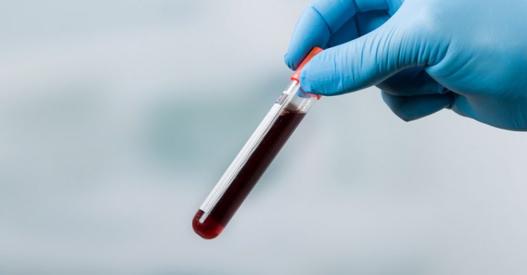 O que é o exame hemograma e para que ele serve - Laboratório Fleming - Jundiaí