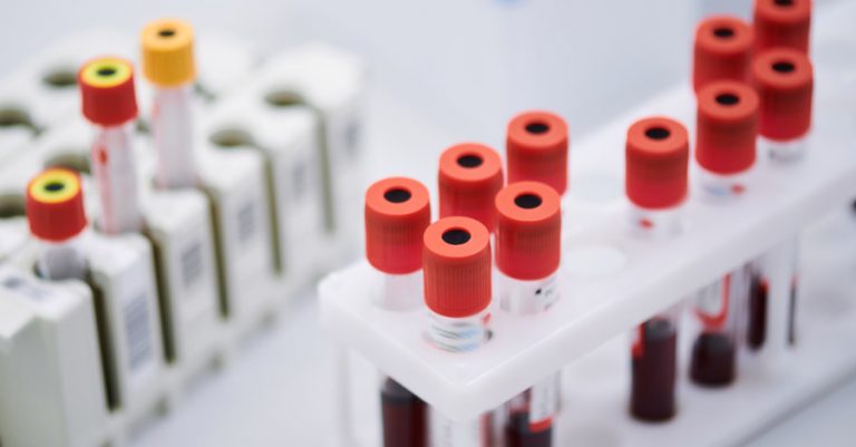 Sangue oculto nas fezes: o que é e para que serve o exame - Laboratório ...