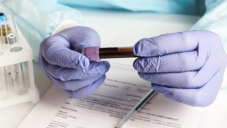 Guia sobre Exames de DST